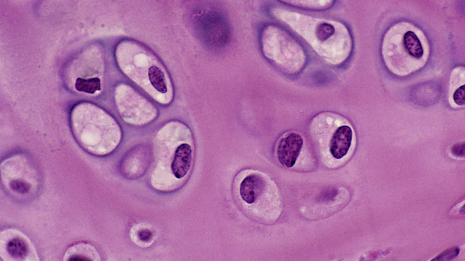 What Is A Cell Tigtag